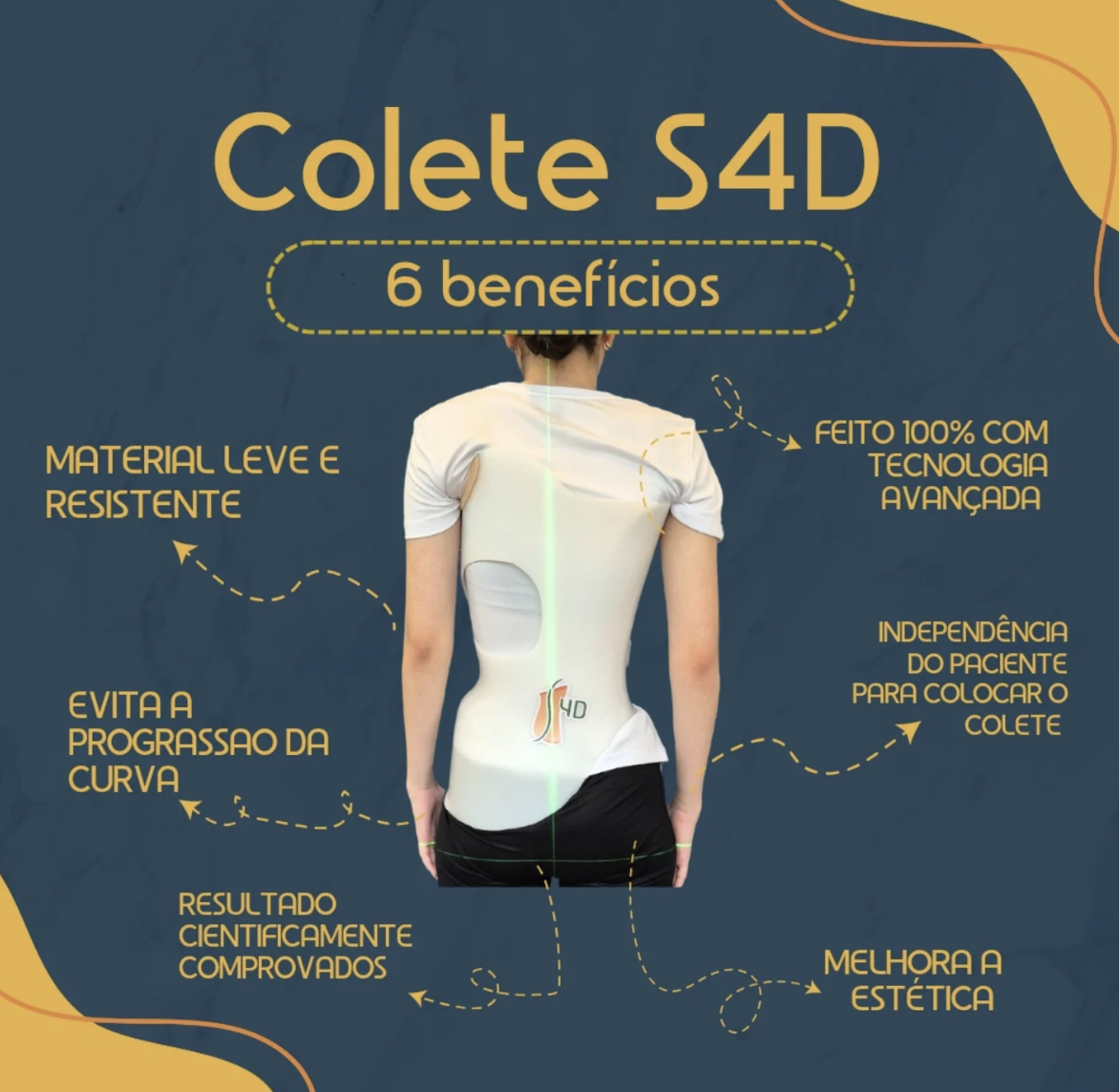 Escoliose e colete: quando é indicado e como funciona – Escoliose Brasil
